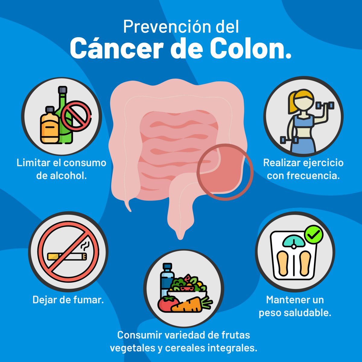 Cáncer de Colon – Acudir Emergencias Médicas